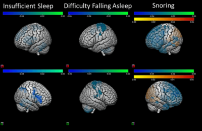 Poor sleep can be devastating for a pre-teen's brain